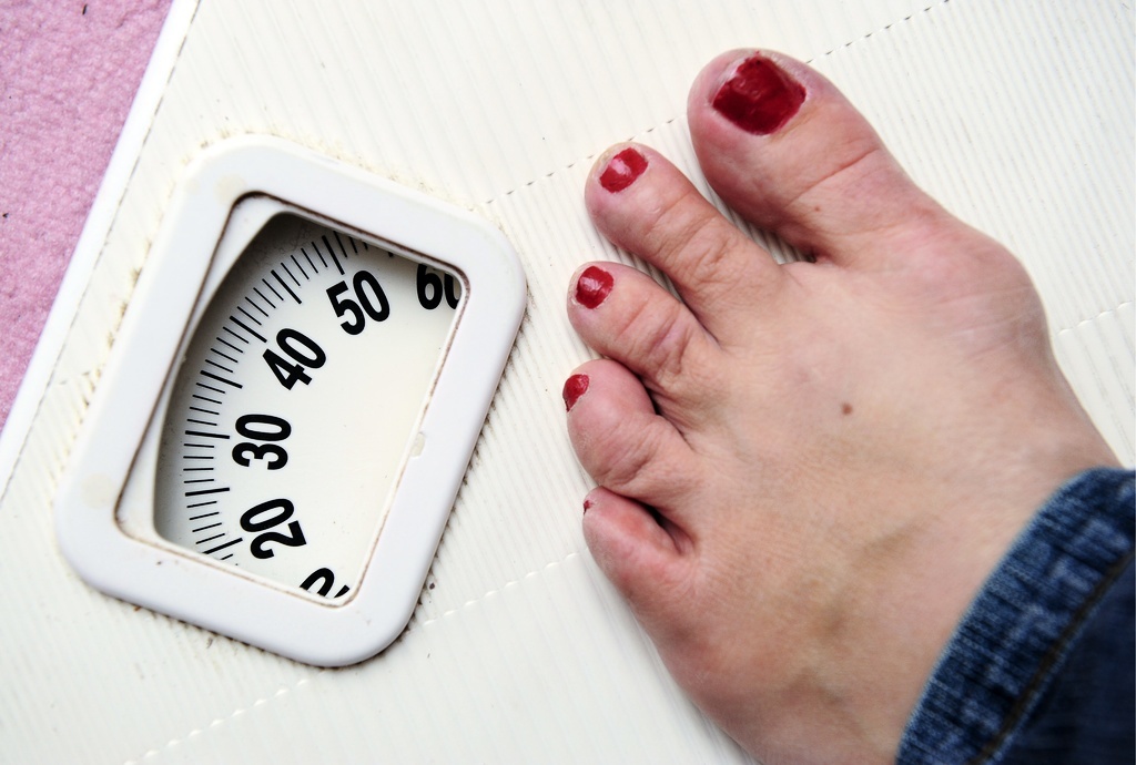 Döttrar till kvinnor som haft anorexia studeras