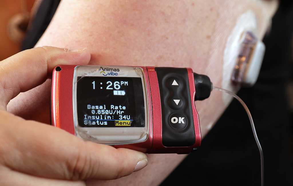 Ryssland spionklassar diabetesgrupp